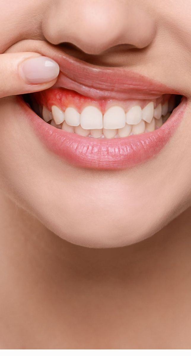 Edge to Edge Bite | Kharsa Clinics